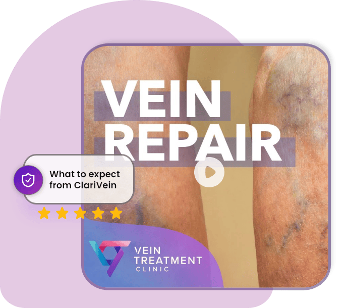 Learn more bout the Clarivein vein treatment