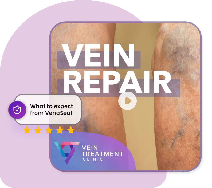 Vein Doctor - Venaseal Treatment for Women | Vein Treatment Center
