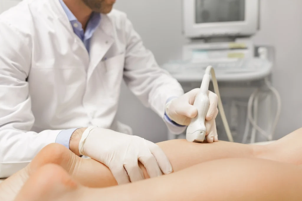 Who is the best doctor for spider veins in Astoria? - VeinDoctor